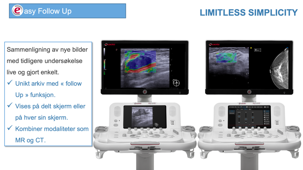 Esaote MyLab X75 ultralydapparat - adCARE AS