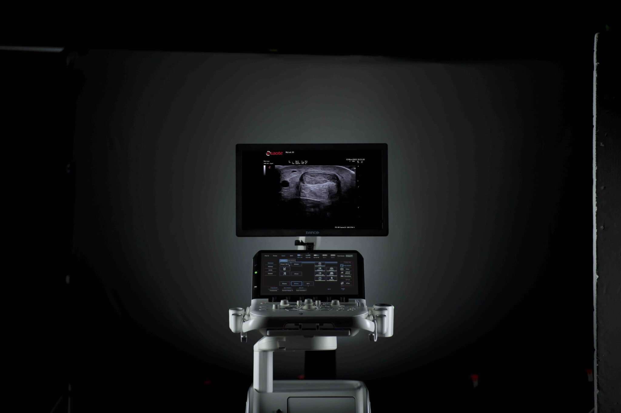 Esaote MyLab X90 - adCARE AS