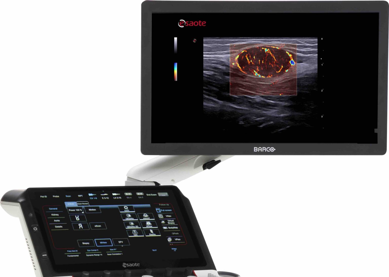 Esaote MyLab X90 - adCARE AS