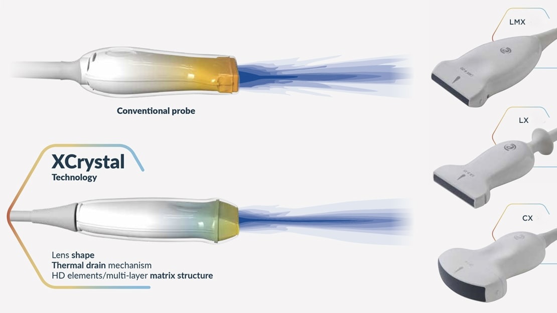 Esaote MyLab X90 - adCARE AS